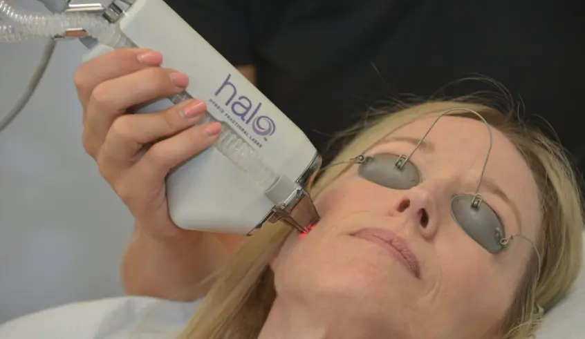 Halo Laser Skin Treatment in Portage & St. Joseph, MI